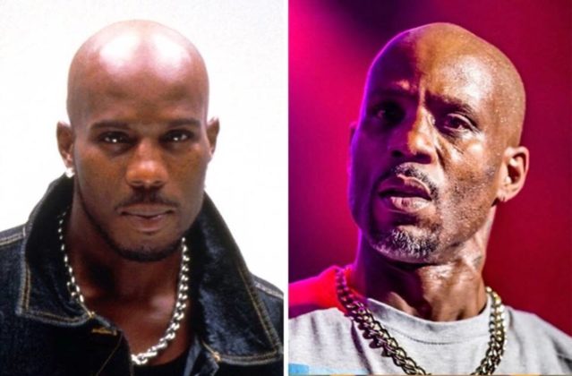 Horrible: 18 Shocking Photos Of Famous Celebrities Before And After ...