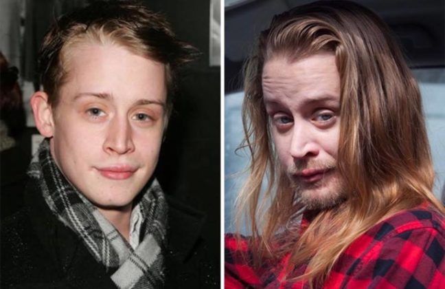 Horrible: 18 Shocking Photos Of Famous Celebrities Before And After ...