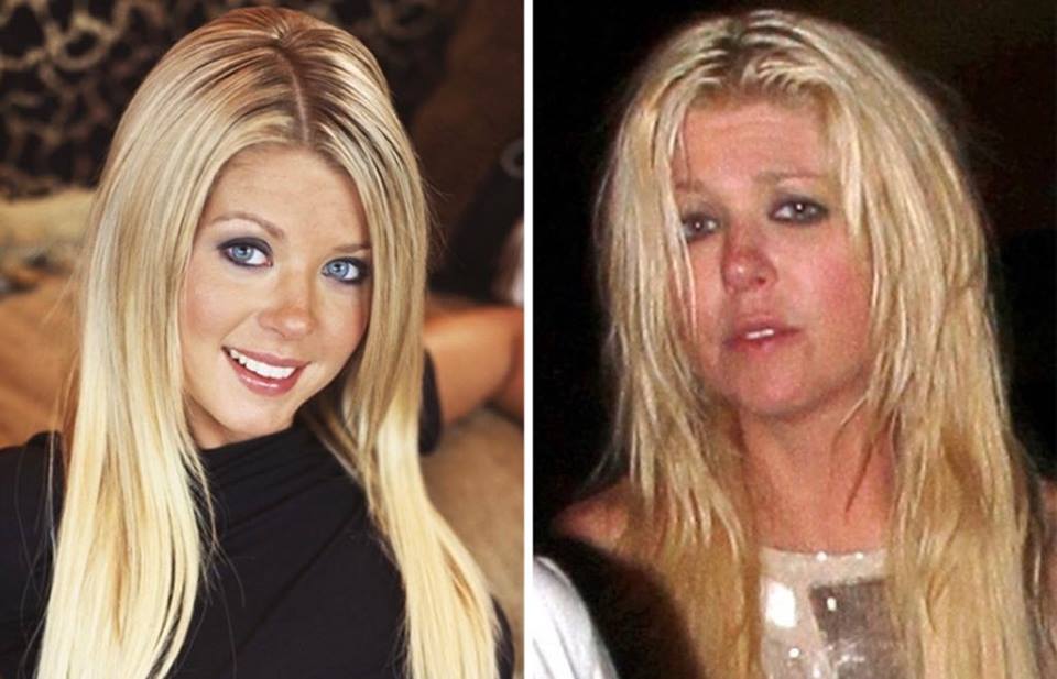 Horrible: 18 Shocking Photos Of Famous Celebrities Before And After ...