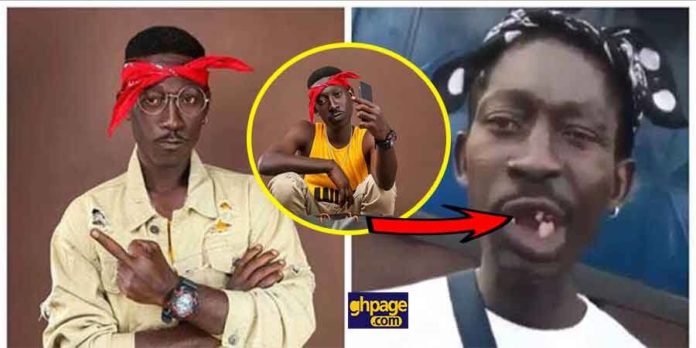 Supa aka Ghana 2Pac shares the sad story of how he lost all his teeth