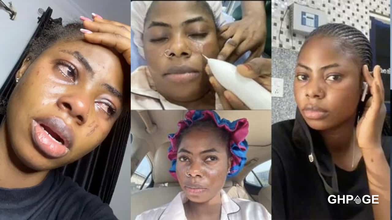 Lady in tears after surgery to remove tribal marks went wrong