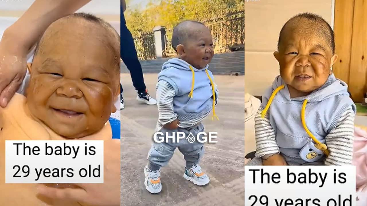 29-year-old man still a baby as rare medical condition stops him from ...