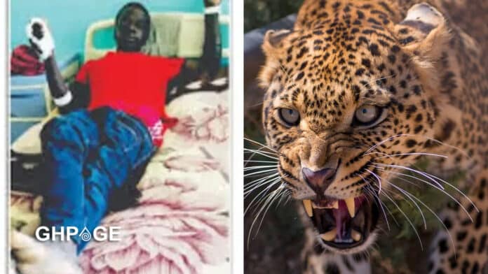 Man hospitalised after leopard attacked while easing himself in a bush ...