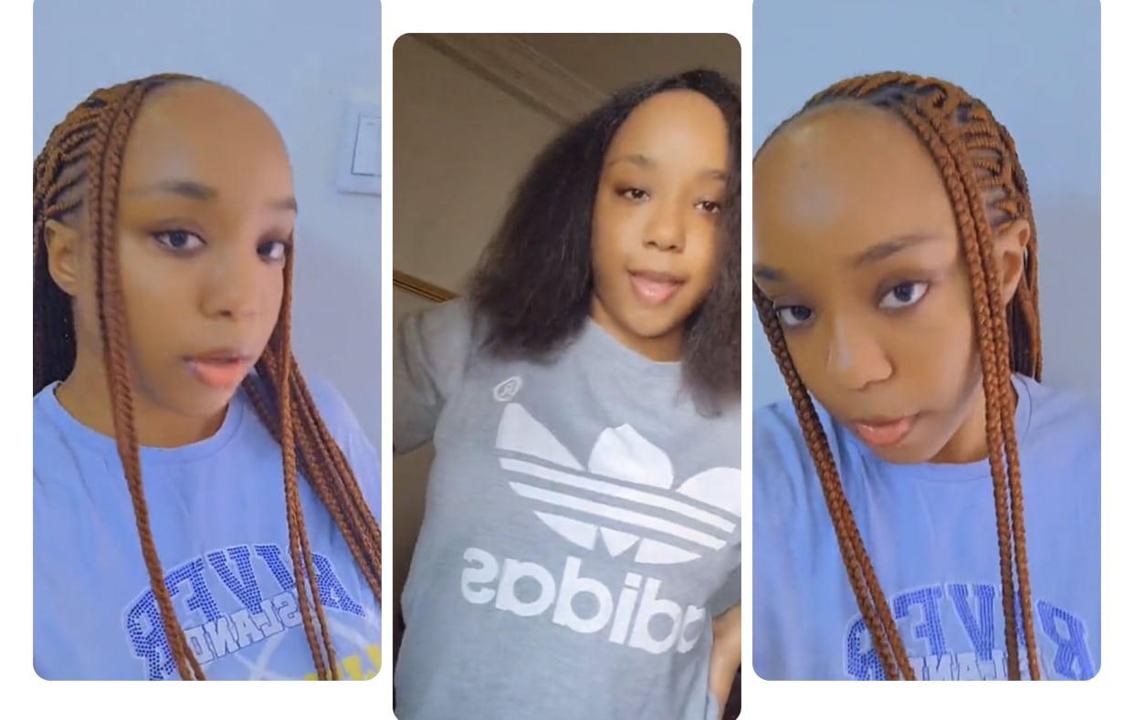 “You are beautiful”; Lady with extra large forehead flaunt her beauty ...